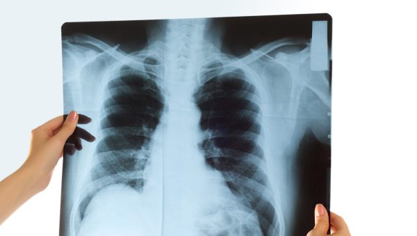 Άρθρα - Thorax Heart